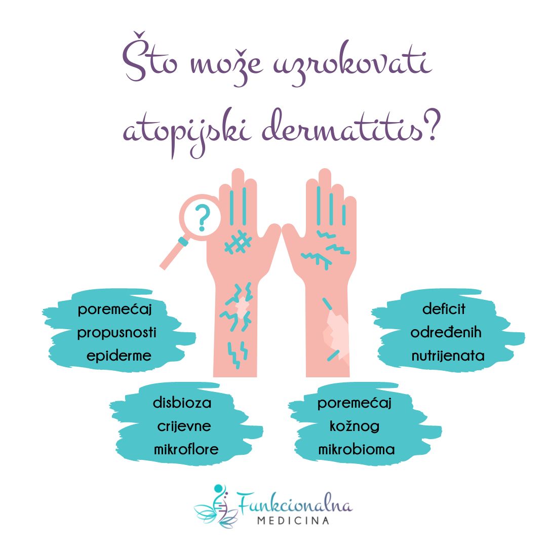 Atopijski dermatitis je sve češći kod odraslih osoba, kako mu doskočiti ...